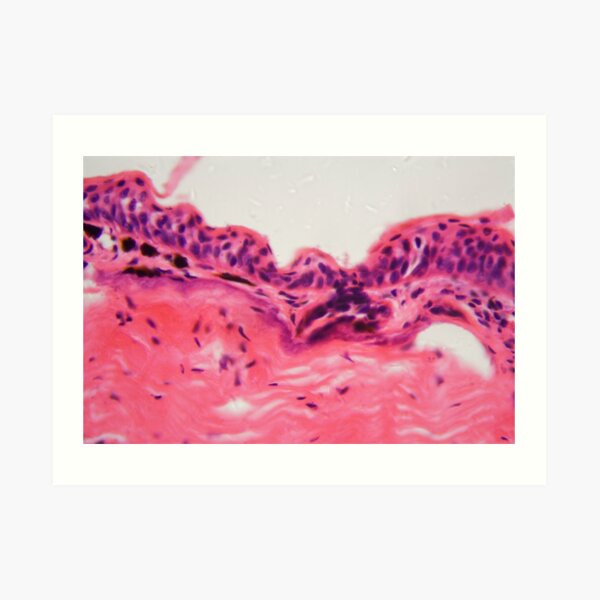 "Amphibian skin with ulcer under a microscope" Art Print by Zosimus ...