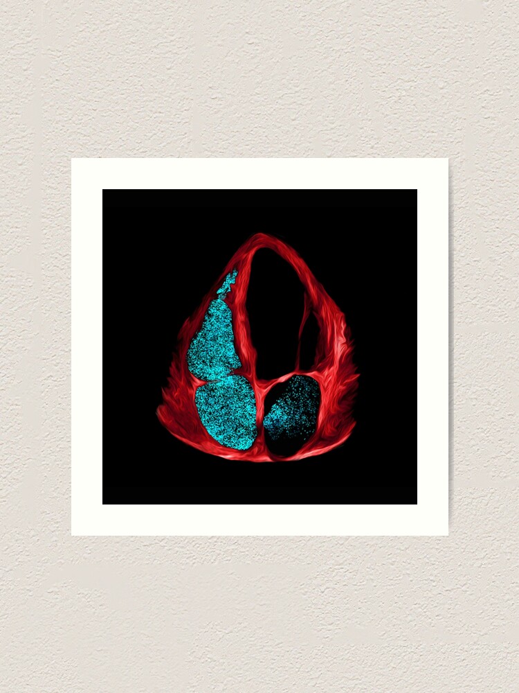 "Bubbles PFO" Art Print for Sale by EchoArtUK | Redbubble