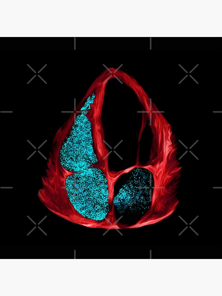 "Bubbles PFO" Art Print for Sale by EchoArtUK | Redbubble