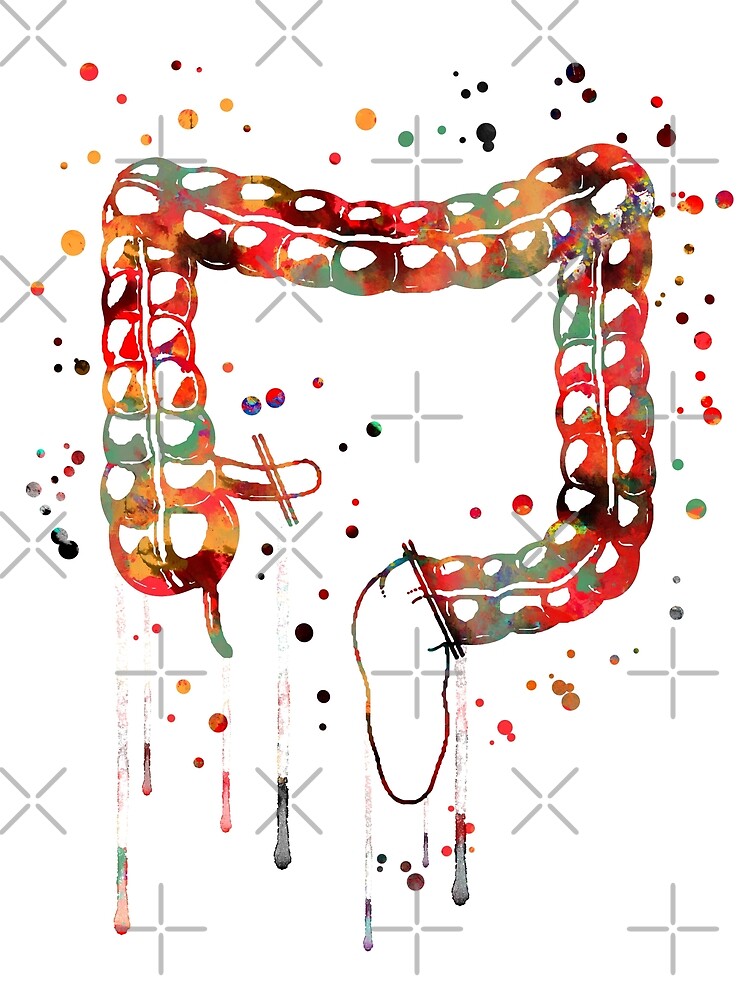 Lámina fotográfica «Tracto gastrointestinal inferior, sistema digestivo ...