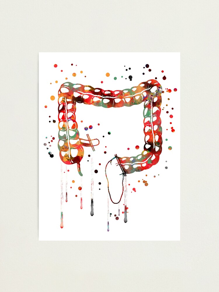 Lámina fotográfica «Tracto gastrointestinal inferior, sistema digestivo ...