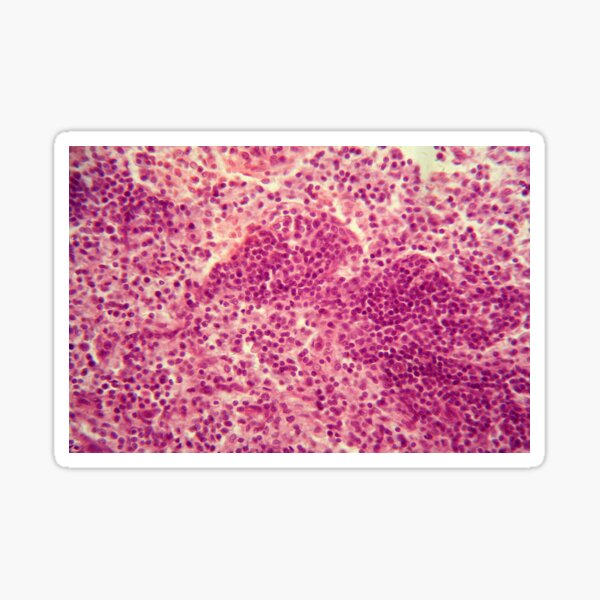 "A section trough lymph node cells under the microscope." Sticker by ...