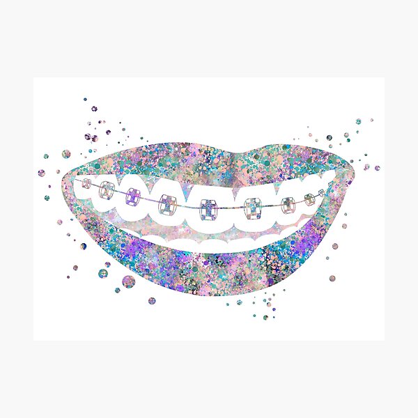 "Teeth braces, dental anatomy" Photographic Print for Sale by ...