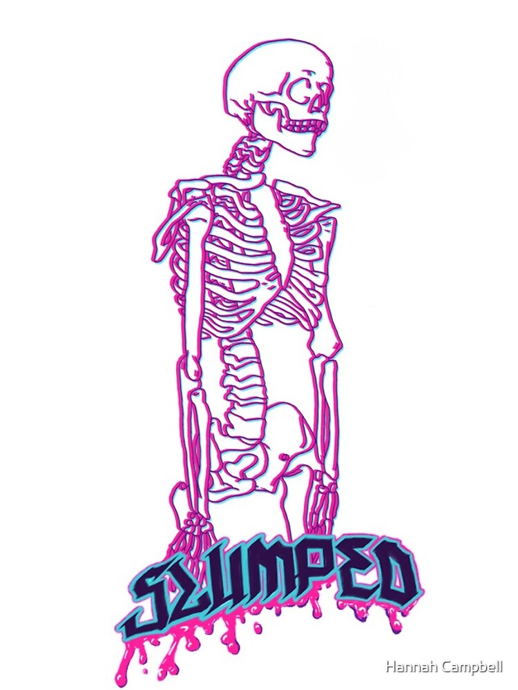 "Slumped Skeleton" iPhone Case for Sale by HCampbellArt | Redbubble