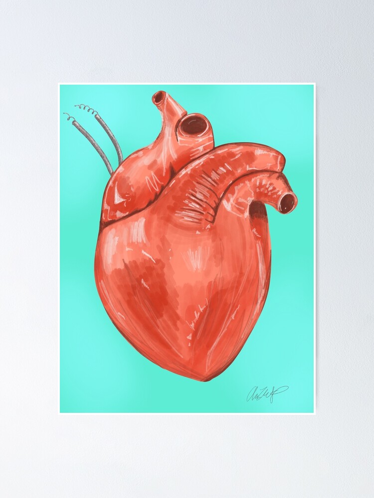 "Anatomical Heart With Pacemaker Medical Art Doctor Cardiologist ...