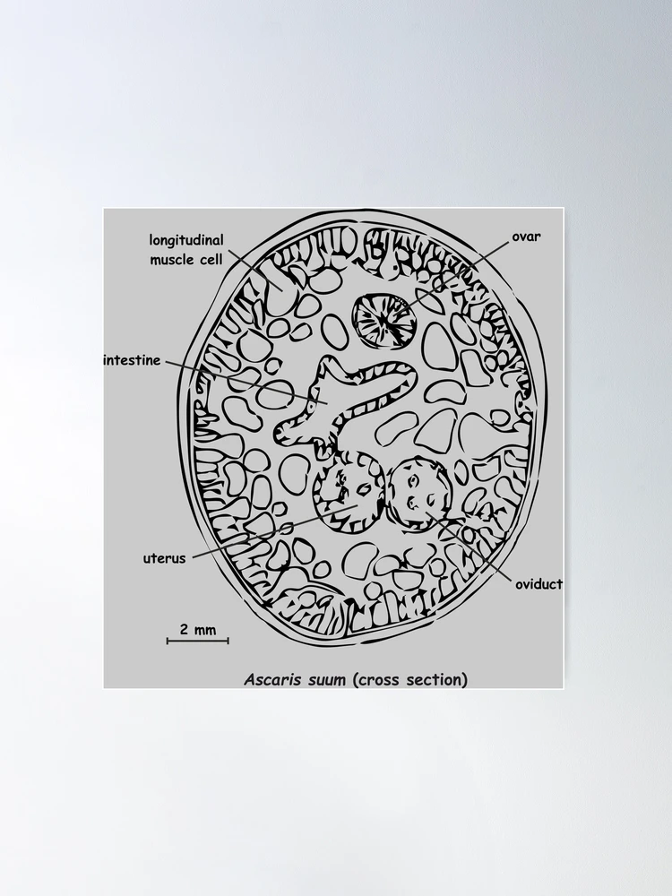 Ascaris Cross Section Female Uterus Zoology Map
