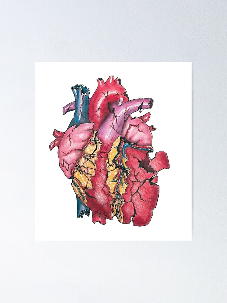Póster «Corazón roto | Patología del corazón | emo corazon» de KMogen5 ...