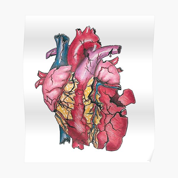 Póster «Corazón roto | Patología del corazón | emo corazon» de KMogen5 ...