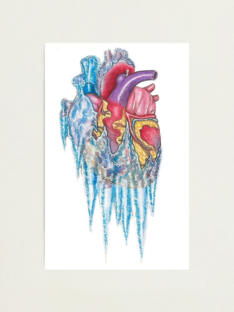 Lámina fotográfica «Corazón frío | Patología del Corazón | Corazón de ...