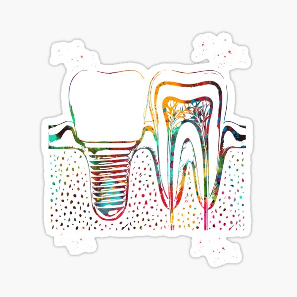 "Human teeth and dental implant" Sticker for Sale by erzebetth | Redbubble