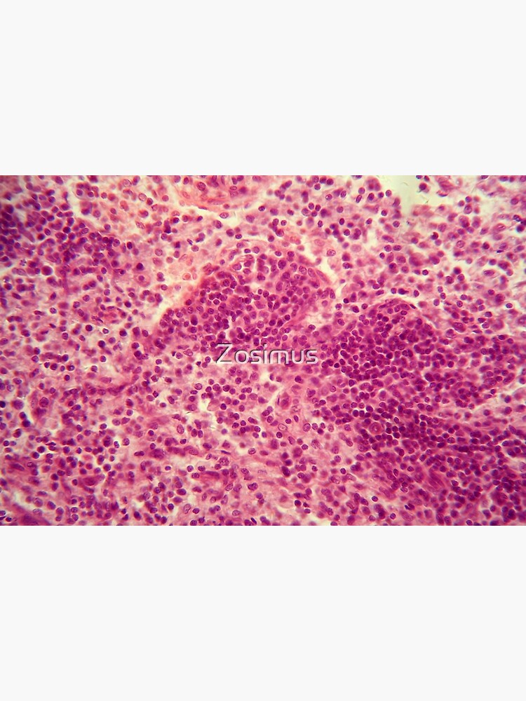 "A section trough lymph node cells under the microscope." Poster by ...