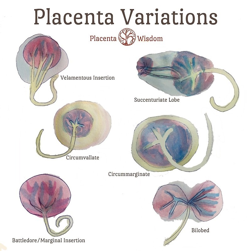 "Placenta Variation Watercolour Drawings" by placentawisdom | Redbubble