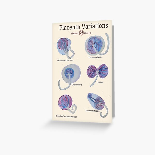 "Placenta Variations Teaching" Greeting Card by placentawisdom | Redbubble