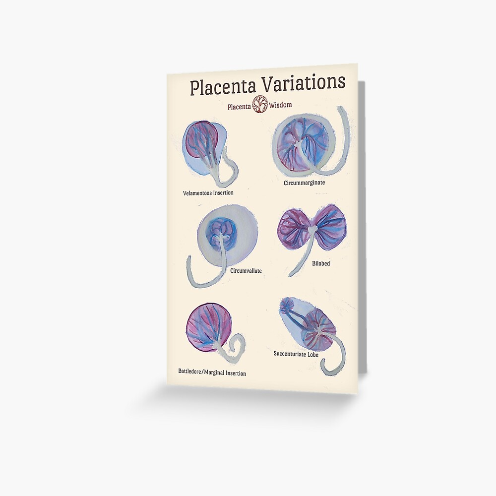 "Placenta Variations Teaching" Greeting Card by placentawisdom | Redbubble