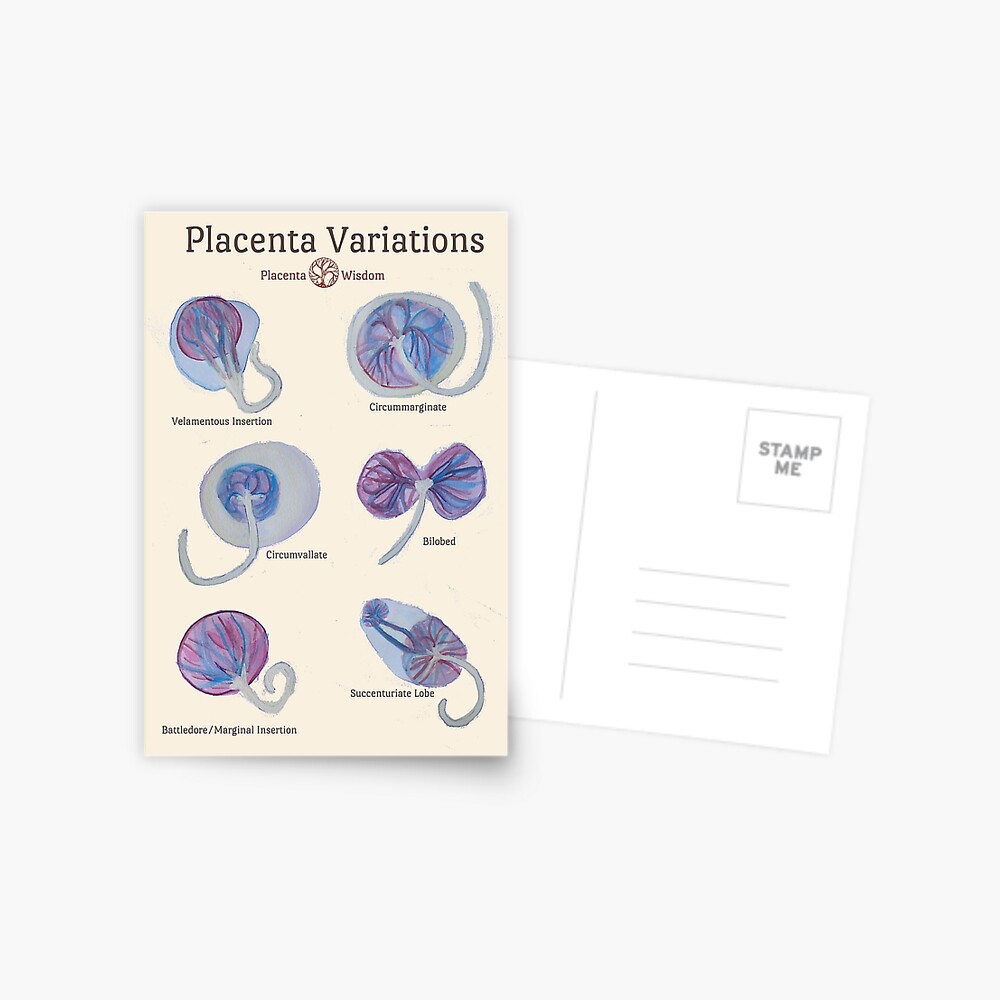 "Placenta Variations Teaching" Postcard for Sale by placentawisdom ...
