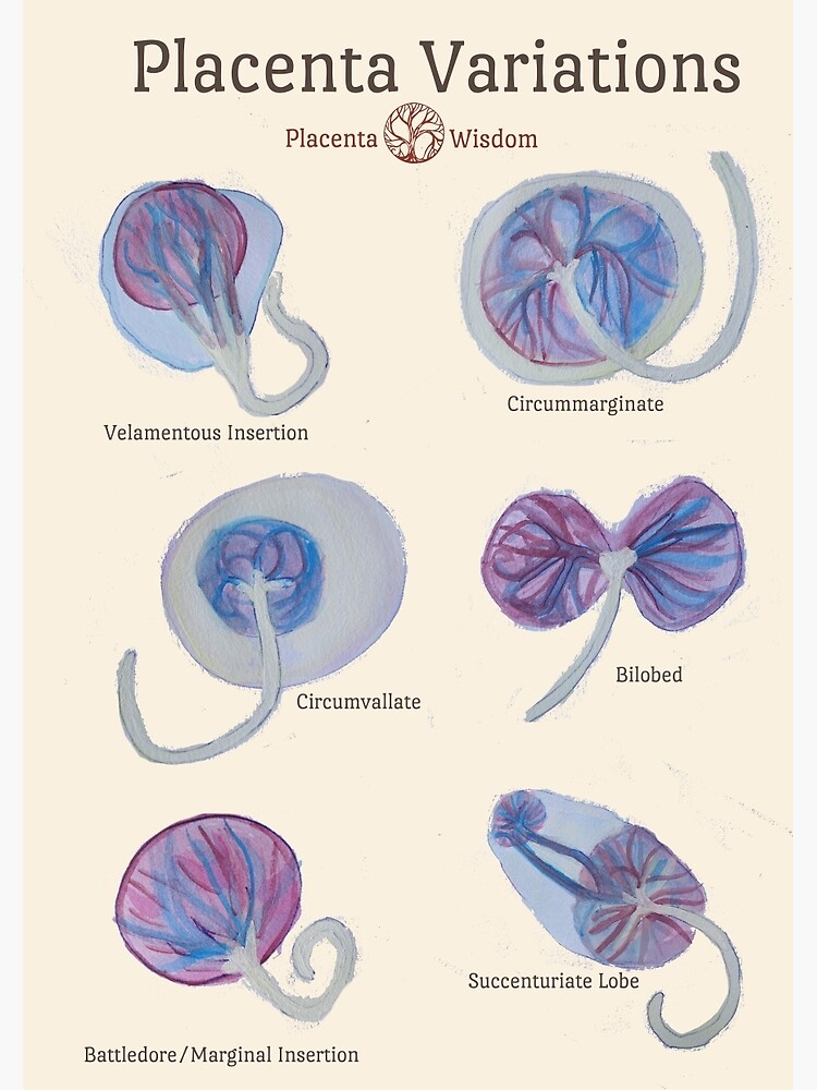 "Placenta Variations Teaching" Spiral Notebook by placentawisdom ...