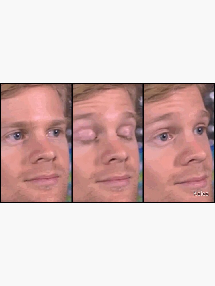 "WHITE BLINKING GUY MEME" Art Print by Keles | Redbubble