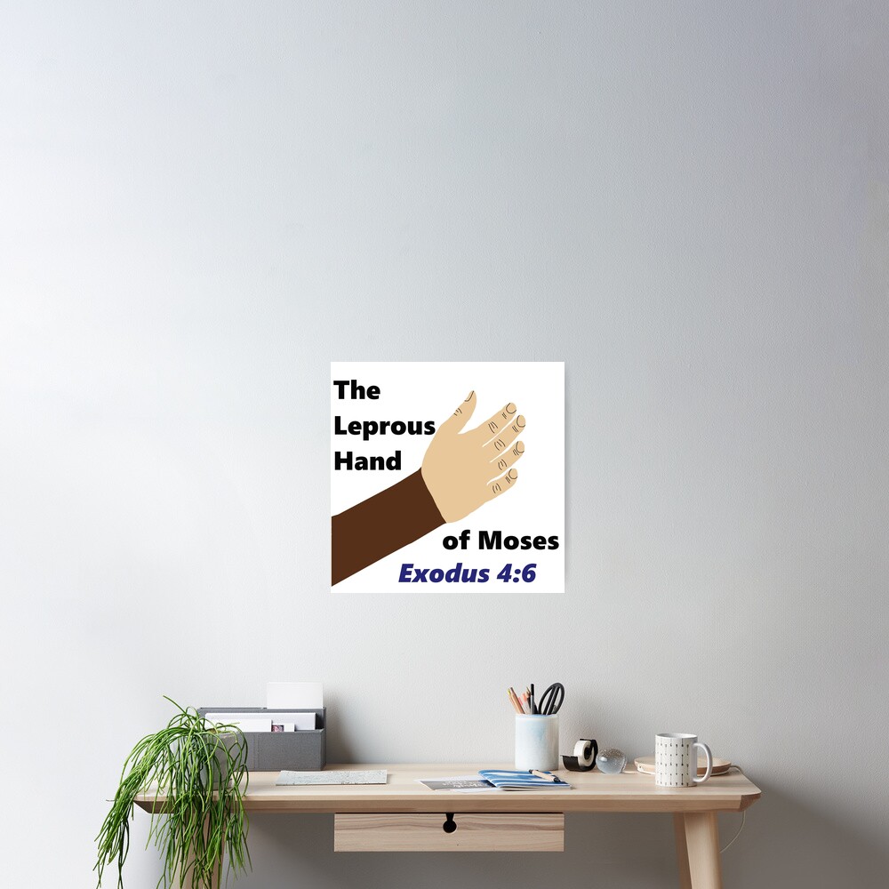 "Moses was Black - The Leprous Hand of Moses - Exodus 4:6 - Put now ...