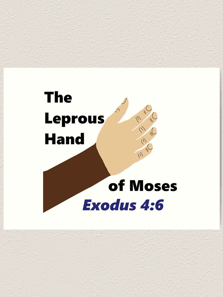 "Moses was Black - The Leprous Hand of Moses - Exodus 4:6 - Put now ...