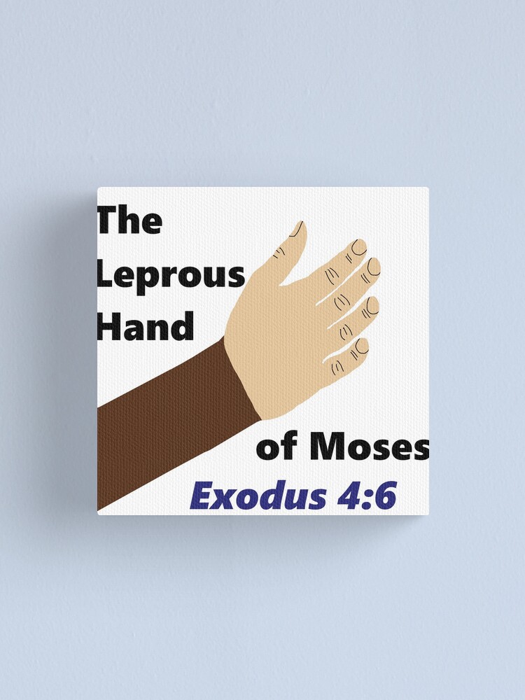 "Moses was Black - The Leprous Hand of Moses - Exodus 4:6 - Put now ...
