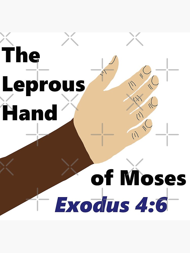 "Moses was Black - The Leprous Hand of Moses - Exodus 4:6 - Put now ...