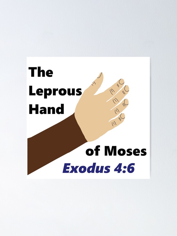 "Moses was Black - The Leprous Hand of Moses - Exodus 4:6 - Put now ...