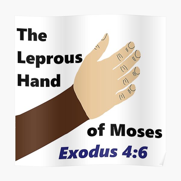 "Moses was Black - The Leprous Hand of Moses - Exodus 4:6 - Put now ...