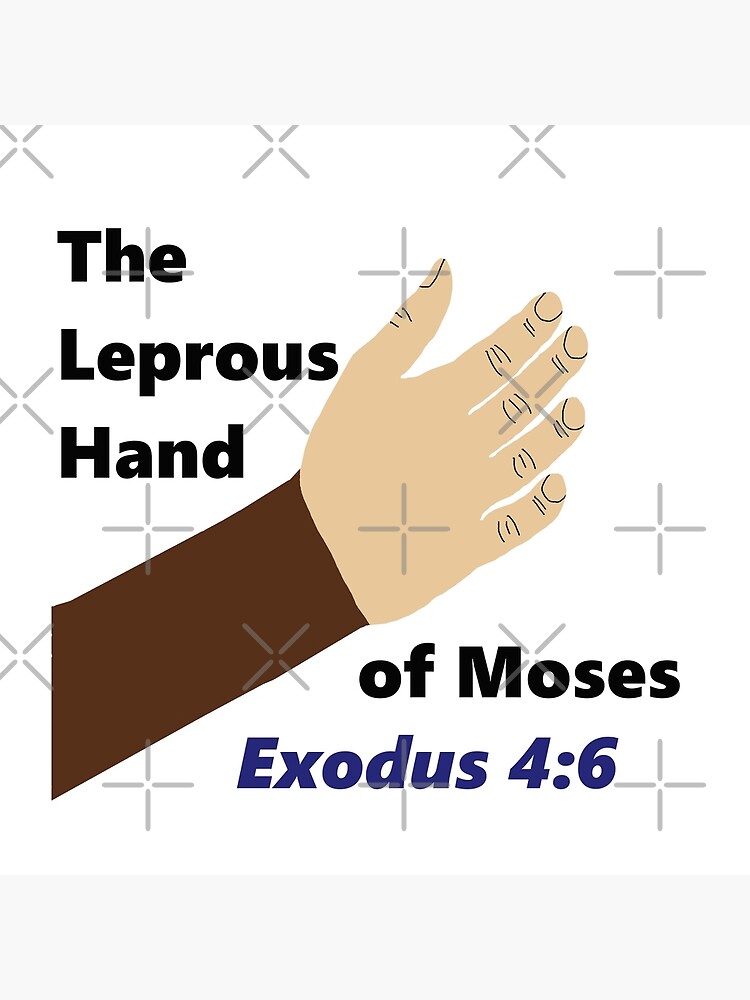 "Moses was Black - The Leprous Hand of Moses - Exodus 4:6 - Put now ...