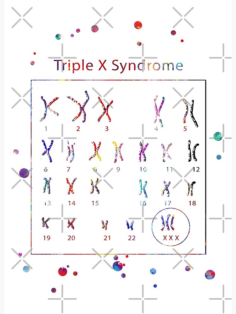 Cariotipo Del Síndrome Triple X